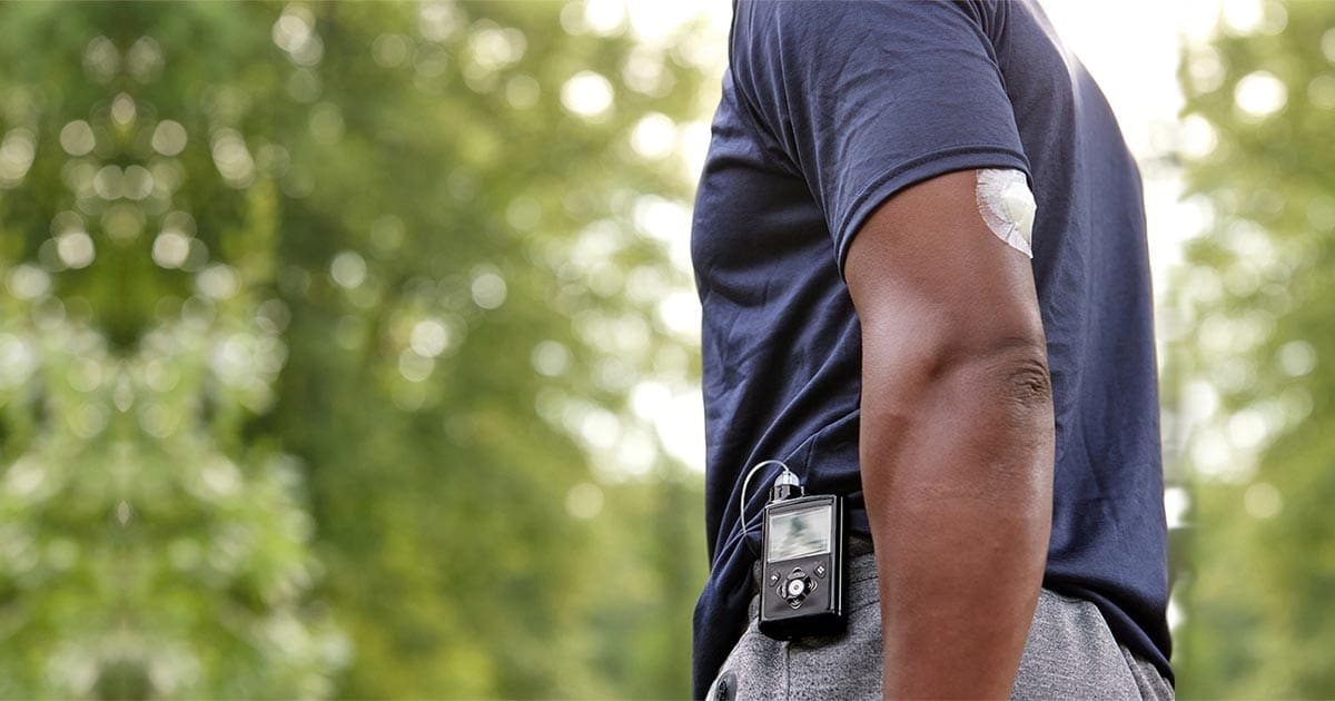 What are Automated Insulin Delivery Systems? | Medtronic