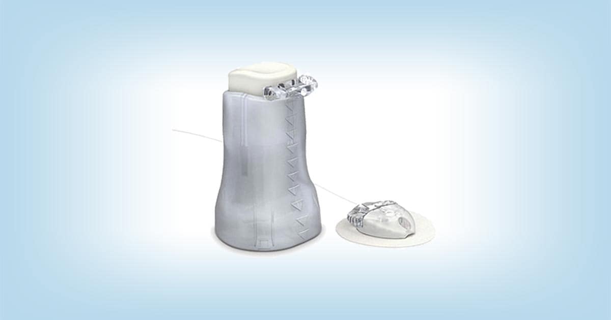 Types Of Medtronic Infusion Sets at Joann Finkelstein blog