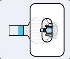 Changing Your Sensor | Medtronic Diabetes