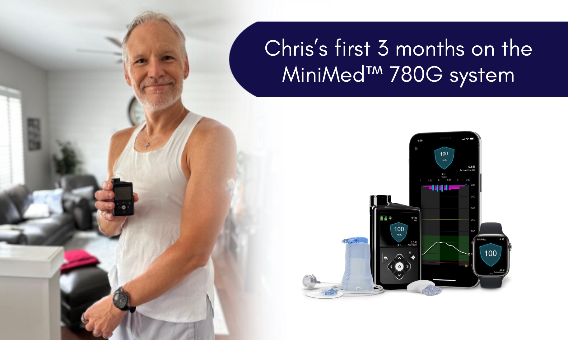 How to remotely upgrade to the MiniMed™ 780G system | Medtronic Diabetes
