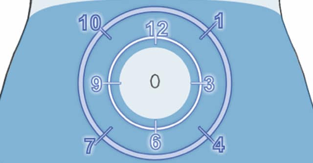 Lumps and bumps around insulin injection sites | Medtronic Diabetes