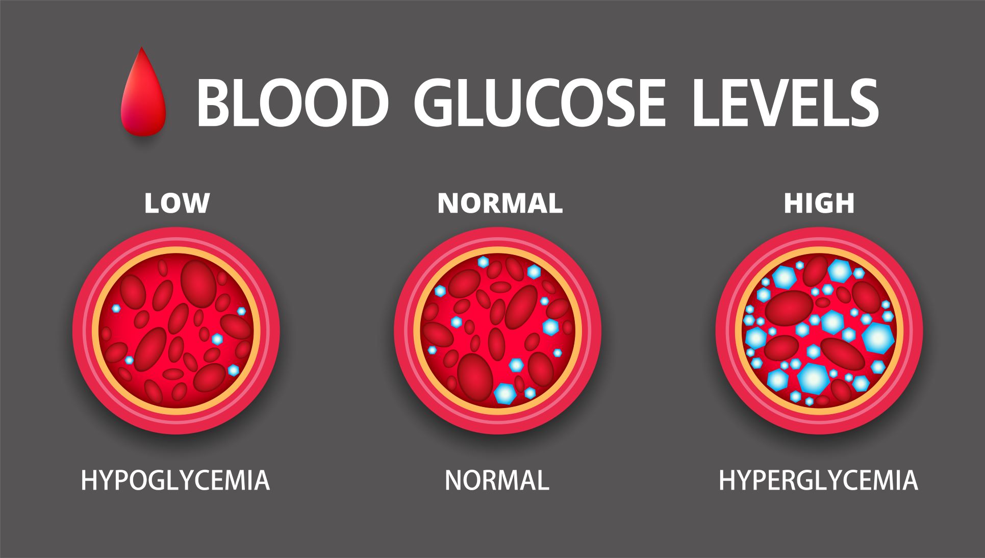 Hyperglycemia vs. Hypoglycemia | Medtronic
